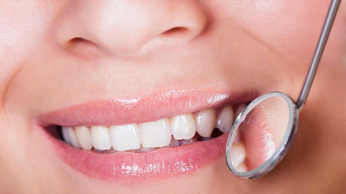 Teeth Cleaning vs. Teeth Whitening | Brentwood TN